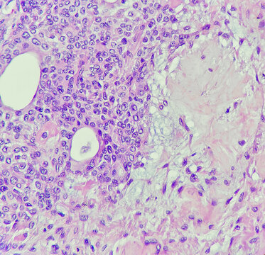 Pleomorphic Images – Browse 137 Stock Photos, Vectors, and Video ...