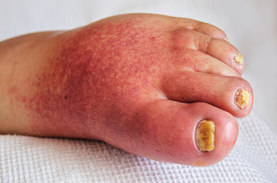 Wundrose Bilder – Durchsuchen 10,092 Archivfotos, Vektorgrafiken und ...