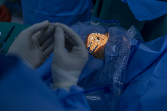 Phaco Bilder – Durchsuchen 336 Archivfotos, Vektorgrafiken und Videos | Adobe Stock