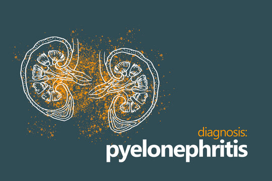 Nephroptosis bilder – Bläddra bland 197 stockfoton, vektorer och videor ...