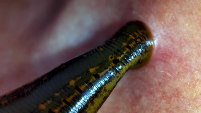 Hirudinidae Images – Parcourir 107 le catalogue de photos, vecteurs et vidéos | Adobe Stock