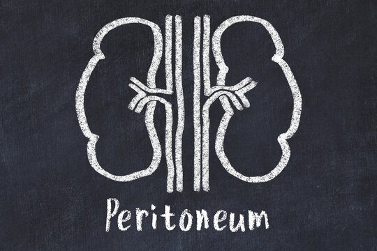 รูปภาพPeritoneum – เลือกดูภาพถ่ายสต็อก เวกเตอร์ และวิดีโอ651 | Adobe Stock