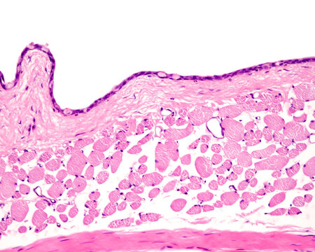 Bindehautsack Bilder – Durchsuchen 1,531 Archivfotos, Vektorgrafiken ...