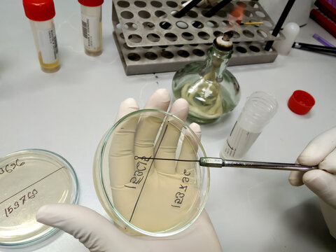 "Urine Culture" Images – Browse 76 Stock Photos, Vectors, and Video ...