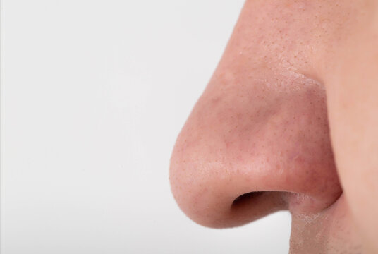 "Big Nose" Imagens – Procure 2,772 fotos, vetores e vídeos | Adobe Stock