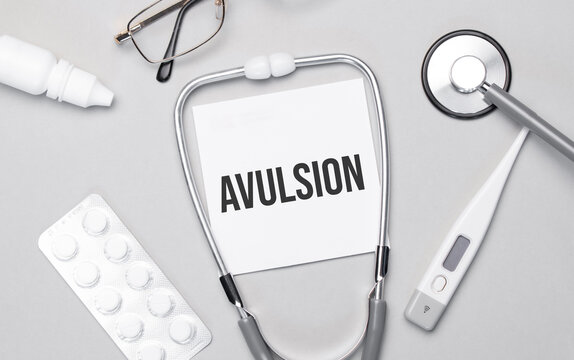 รูปภาพAvulsion – เลือกดูภาพถ่ายสต็อก เวกเตอร์ และวิดีโอ152 | Adobe Stock