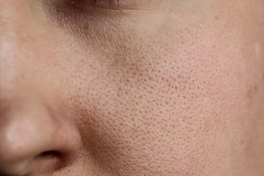 Human Skin Texture Bilder – Durchsuchen 26,530 Archivfotos ...
