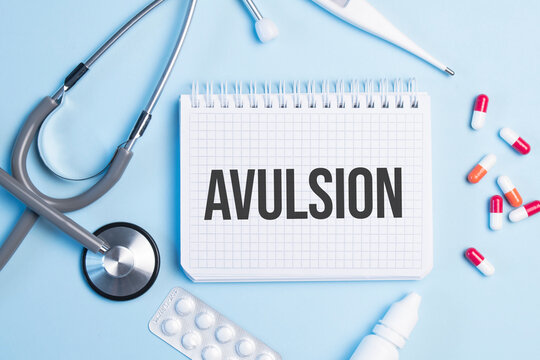 รูปภาพAvulsion – เลือกดูภาพถ่ายสต็อก เวกเตอร์ และวิดีโอ152 | Adobe Stock