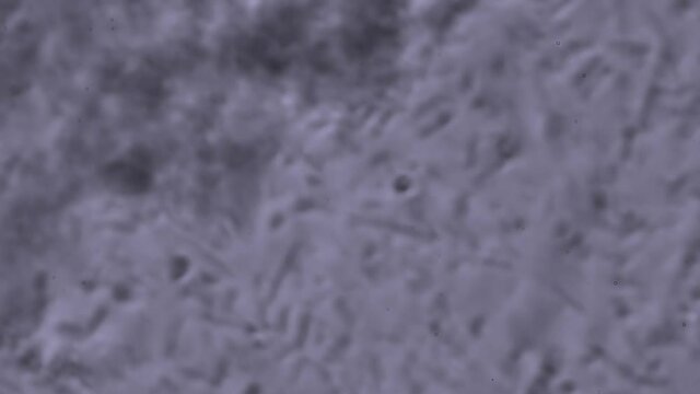 "Human Feces" Images – Browse 544 Stock Photos, Vectors, and Video ...