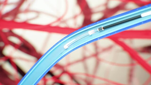 Cauterized Images – Browse 1,594 Stock Photos, Vectors, and Video ...