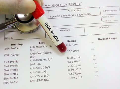 「Ena」の写真素材 | 671件の無料イラスト画像 | Adobe Stock