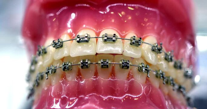Orthodontal Bilder – Durchsuchen 1,481 Archivfotos, Vektorgrafiken und ...