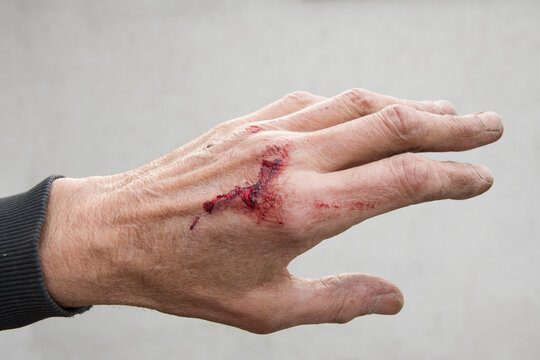 "Bloody Hand" Bilder – Durchsuchen 4,540 Archivfotos, Vektorgrafiken ...