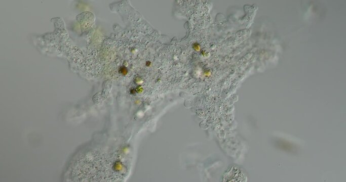 Real Amoeba Pictures