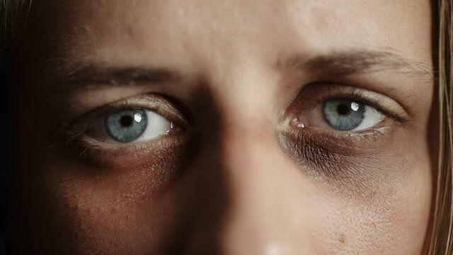 Beat Up Face Images – Browse 20,906 Stock Photos, Vectors, and Video ...