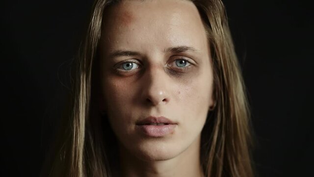 Beat Up Face Images – Browse 21,652 Stock Photos, Vectors, and Video ...