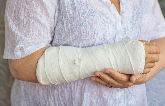 รูปภาพImmobilization – เลือกดูภาพถ่ายสต็อก เวกเตอร์ และวิดีโอ954 ...