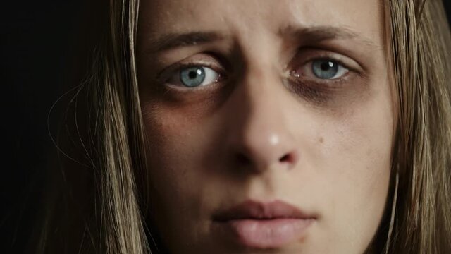 Beat Up Face Images – Browse 21,652 Stock Photos, Vectors, and Video ...