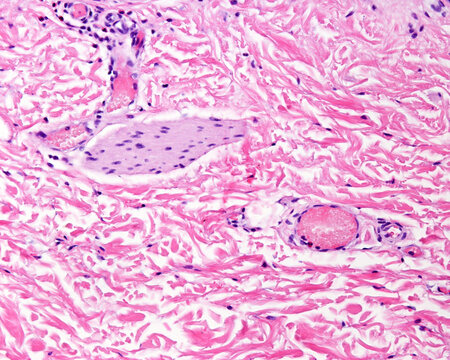 Arrector Pili Muscle Histology