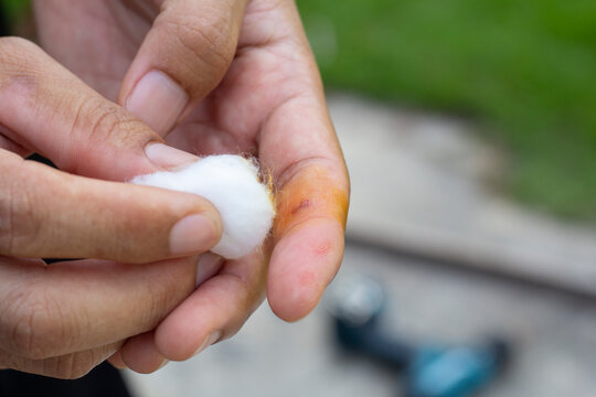 รูปภาพMischance – เลือกดูภาพถ่ายสต็อก เวกเตอร์ และวิดีโอ14,991 | Adobe ...