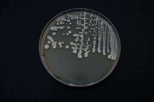 Proteus Mirabilis On Nutrient Agar