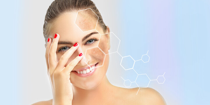 Hyperpigmentation Bilder – Durchsuchen 4,501 Archivfotos ...