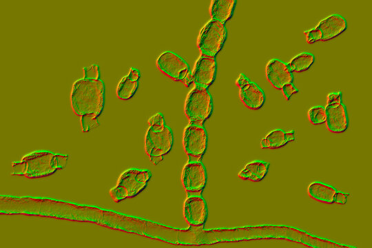 Arthroconidia Images – Browse 37 Stock Photos, Vectors, and Video ...