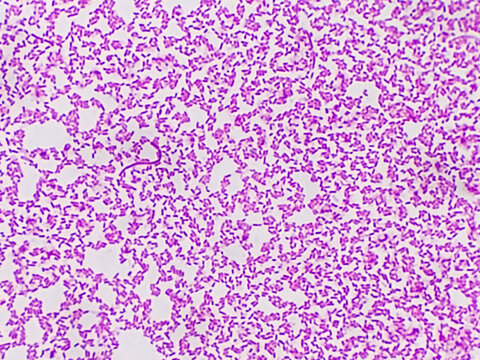 Salmonella Gram Stain