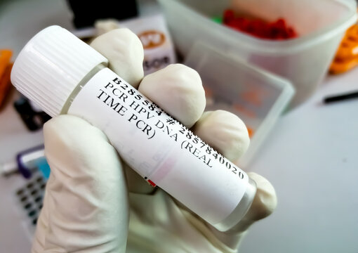 Lubrikation bilder – Bläddra bland 568 stockfoton, vektorer och videor ...