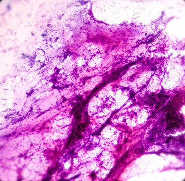 Lsil Images – Browse 48 Stock Photos, Vectors, and Video | Adobe Stock