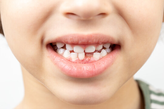 "Front Tooth" Images – Browse 4,191 Stock Photos, Vectors, and Video ...