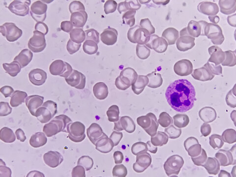 Ovalocytes Images – Browse 74 Stock Photos, Vectors, and Video | Adobe ...