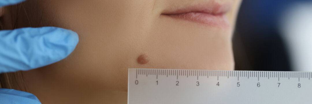 Muttermal Bilder – Durchsuchen 112,773 Archivfotos, Vektorgrafiken und ...