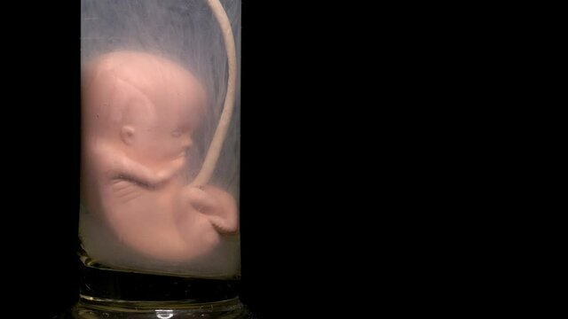 "Human Embryo" Images – Parcourir 1,109 le catalogue de photos ...