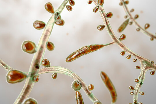 รูปภาพMacroconidia – เลือกดูภาพถ่ายสต็อก เวกเตอร์ และวิดีโอ1,427 ...