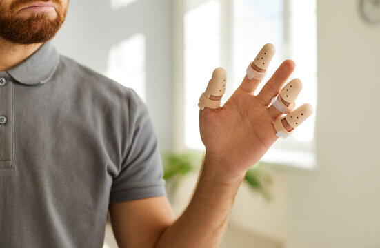 รูปภาพ"Broken Finger" – เลือกดูภาพถ่ายสต็อก เวกเตอร์ และวิดีโอ193 ...