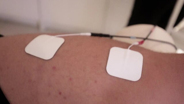 "Electric Stimulation" Images – Browse 886 Stock Photos, Vectors, and ...