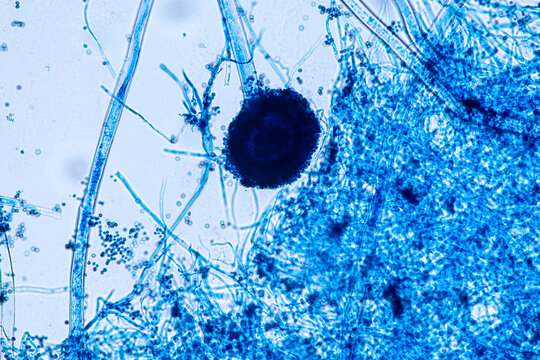 Aspergillus Oryzae"」の写真素材 | 1,131件の無料イラスト画像 | Adobe Stock