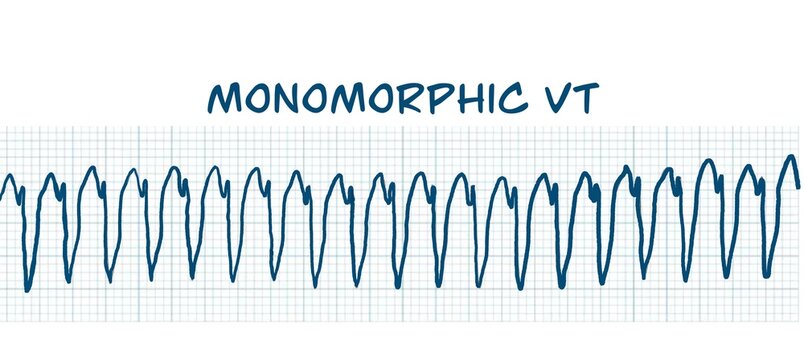 Monomorphic bilder – Bläddra bland 66 stockfoton, vektorer och videor ...