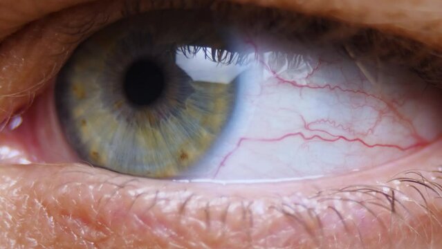 Capillaries Images – Browse 17,334 Stock Photos, Vectors, and Video ...