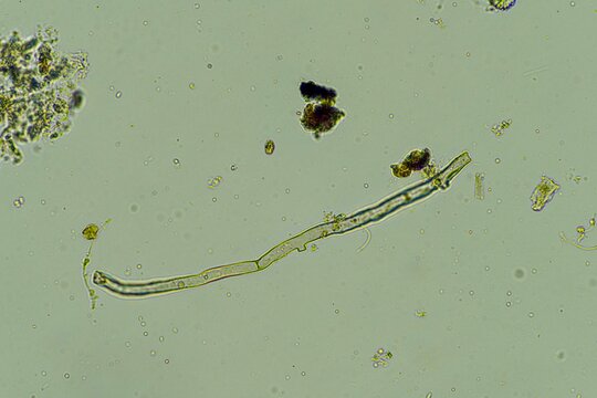 Arthroconidia
