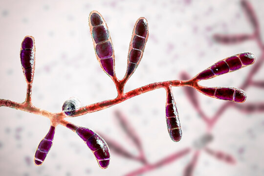 Tinea Cruris Microscope