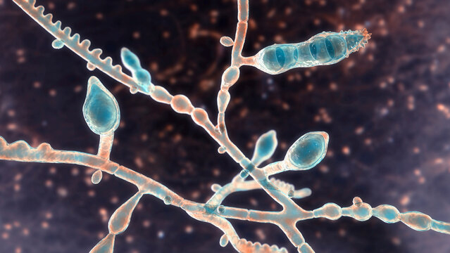 Dermatophyten Bilder – Durchsuchen 1,071 Archivfotos, Vektorgrafiken ...