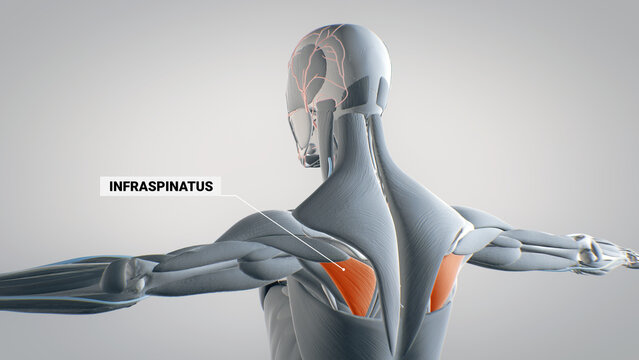 Infraspinatus Pain