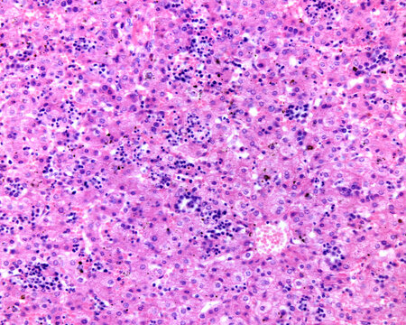 รูปภาพNrbc – เลือกดูภาพถ่ายสต็อก เวกเตอร์ และวิดีโอ73 | Adobe Stock