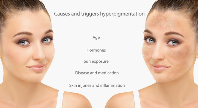 Phototype Images – Browse 217 Stock Photos, Vectors, and Video | Adobe ...