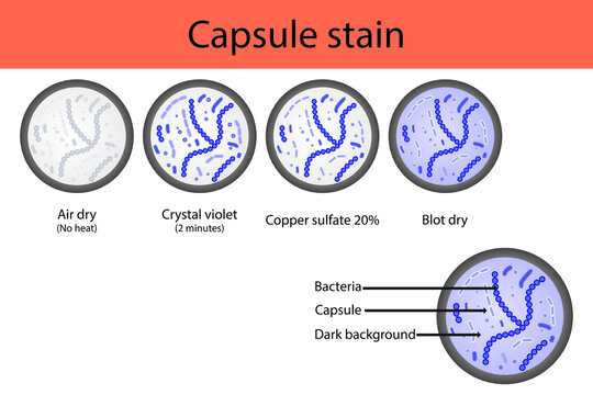 Capsule Stain