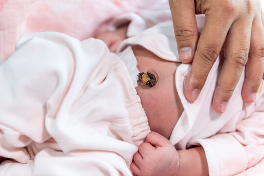 "Umbilical Cord" Images – Browse 3,275 Stock Photos, Vectors, and Video ...