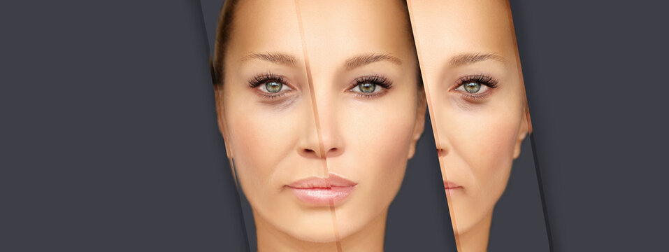 Imágenes de Phototype: descubre bancos de fotos, ilustraciones ...