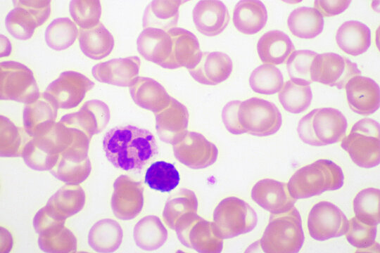 Microcyte Bilder – Durchsuchen 391 Archivfotos, Vektorgrafiken und ...